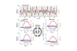Brain's Optical Imaging: Kernel Flow Helmet - 10TechPro