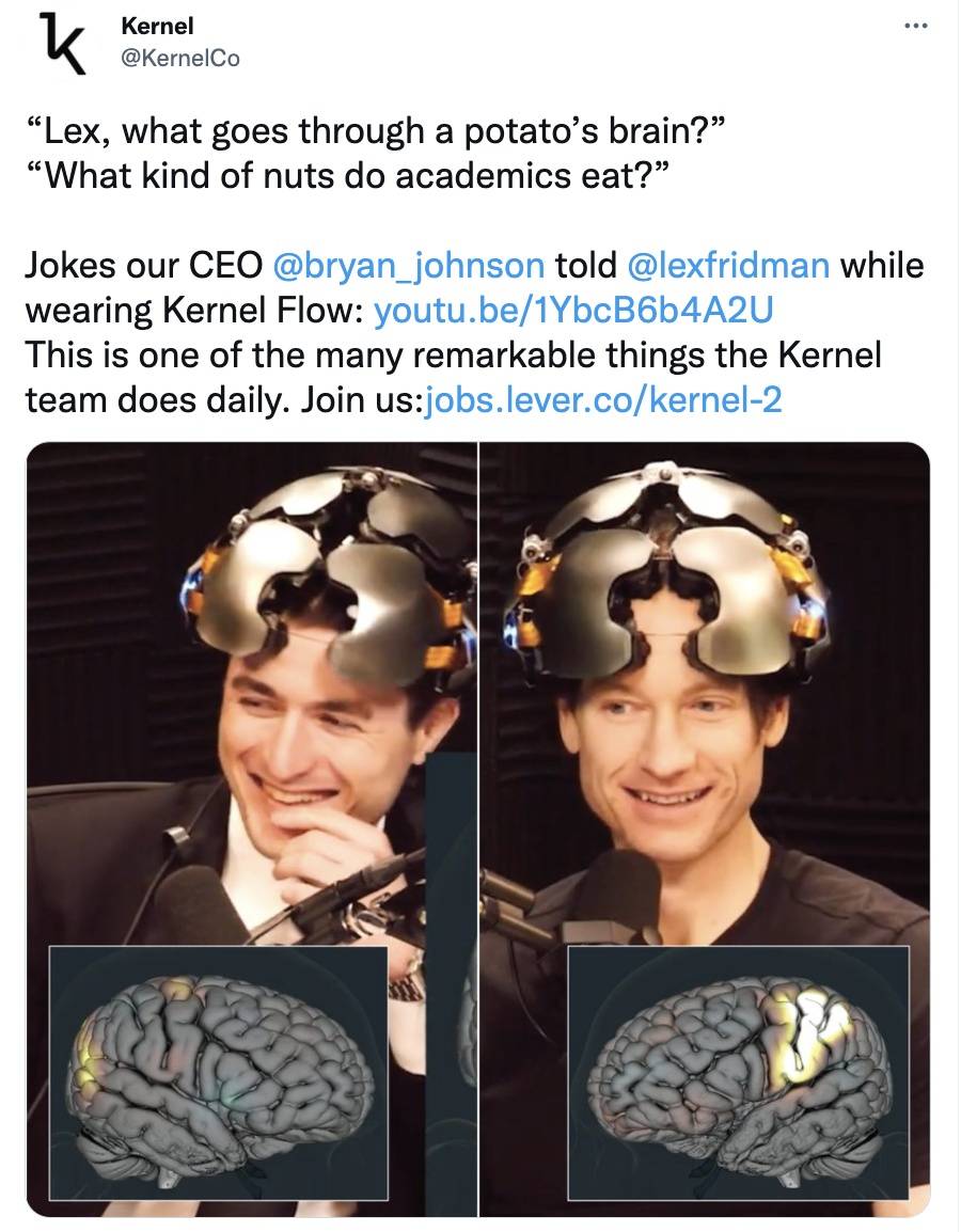 Brain's Optical Imaging: Kernel Flow Helmet - 10TechPro